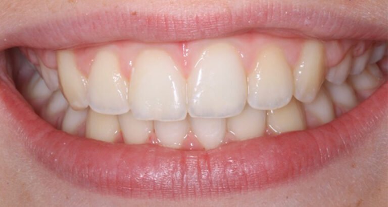 Orthodontie à Casablanca | Centre Dentaire Zerktouni